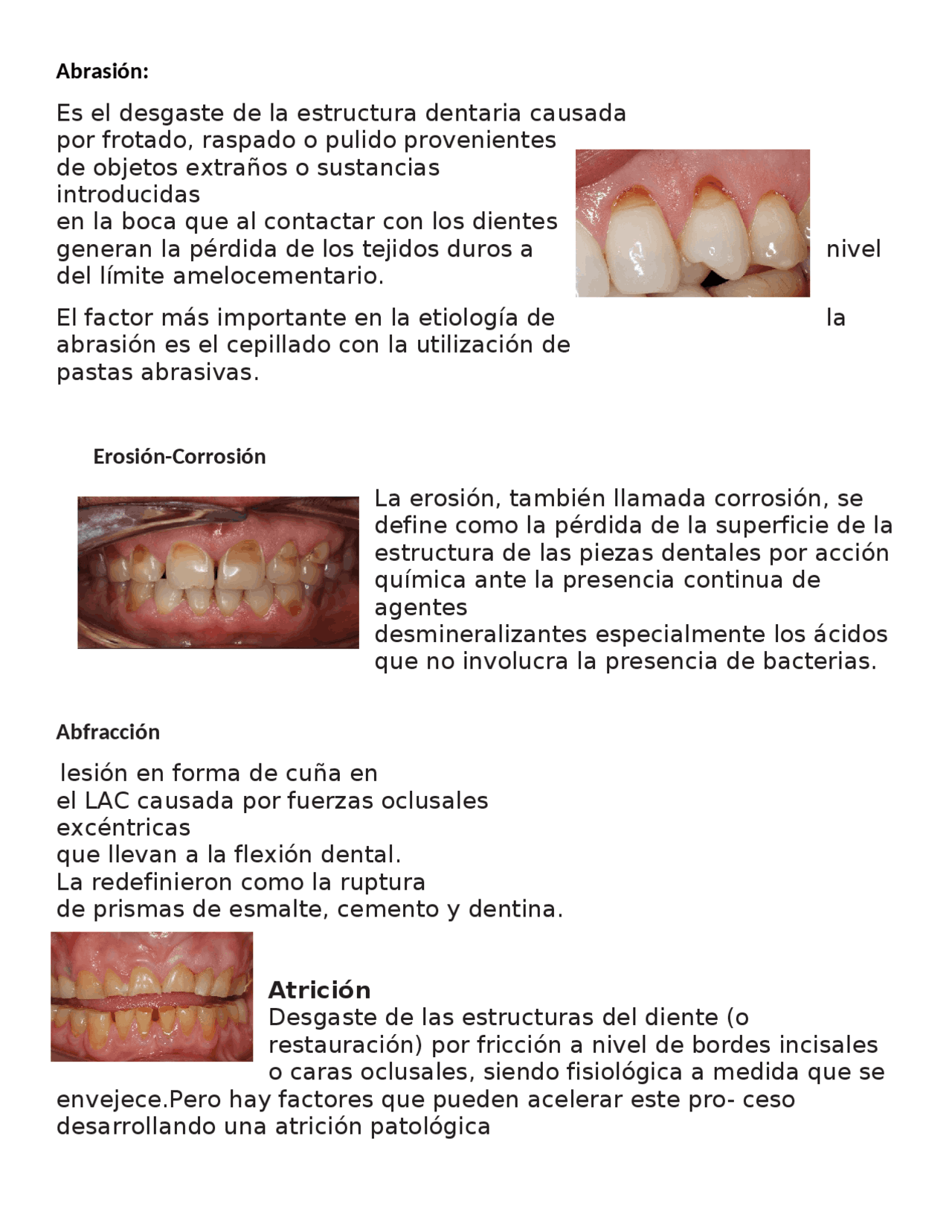 Desgastes cervicales - Docsity