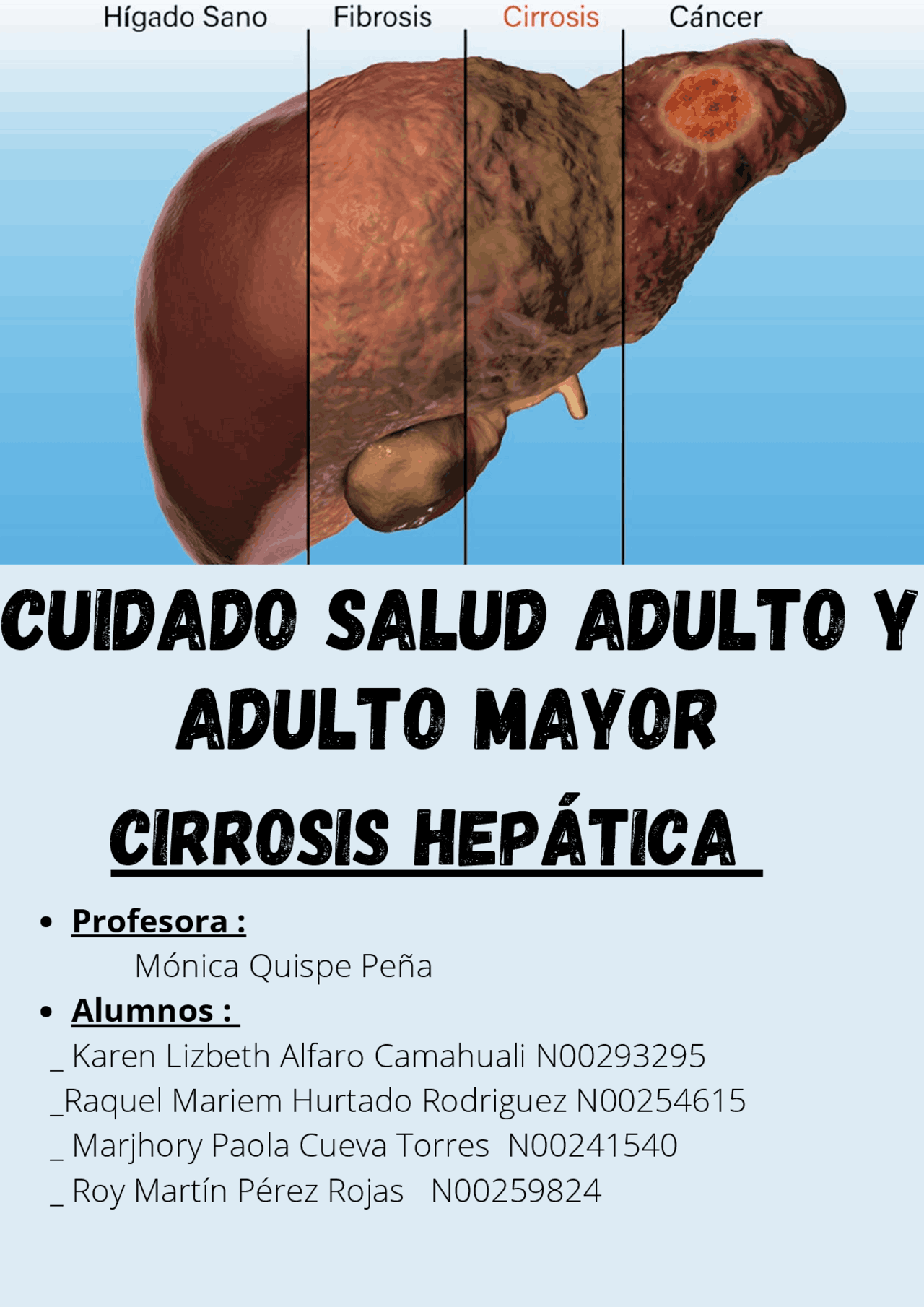 Cirrosis hepatica, caso clinico sobre un paciente adulto de 45 años | Monografías, Ensayos de ...