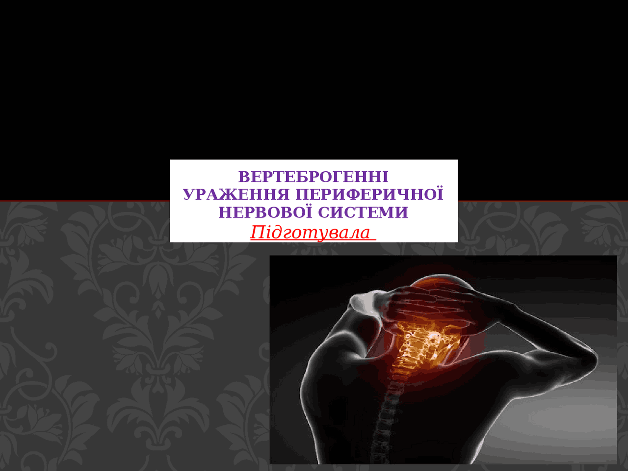 Презентація з неврології Презентации Неврология Docsity