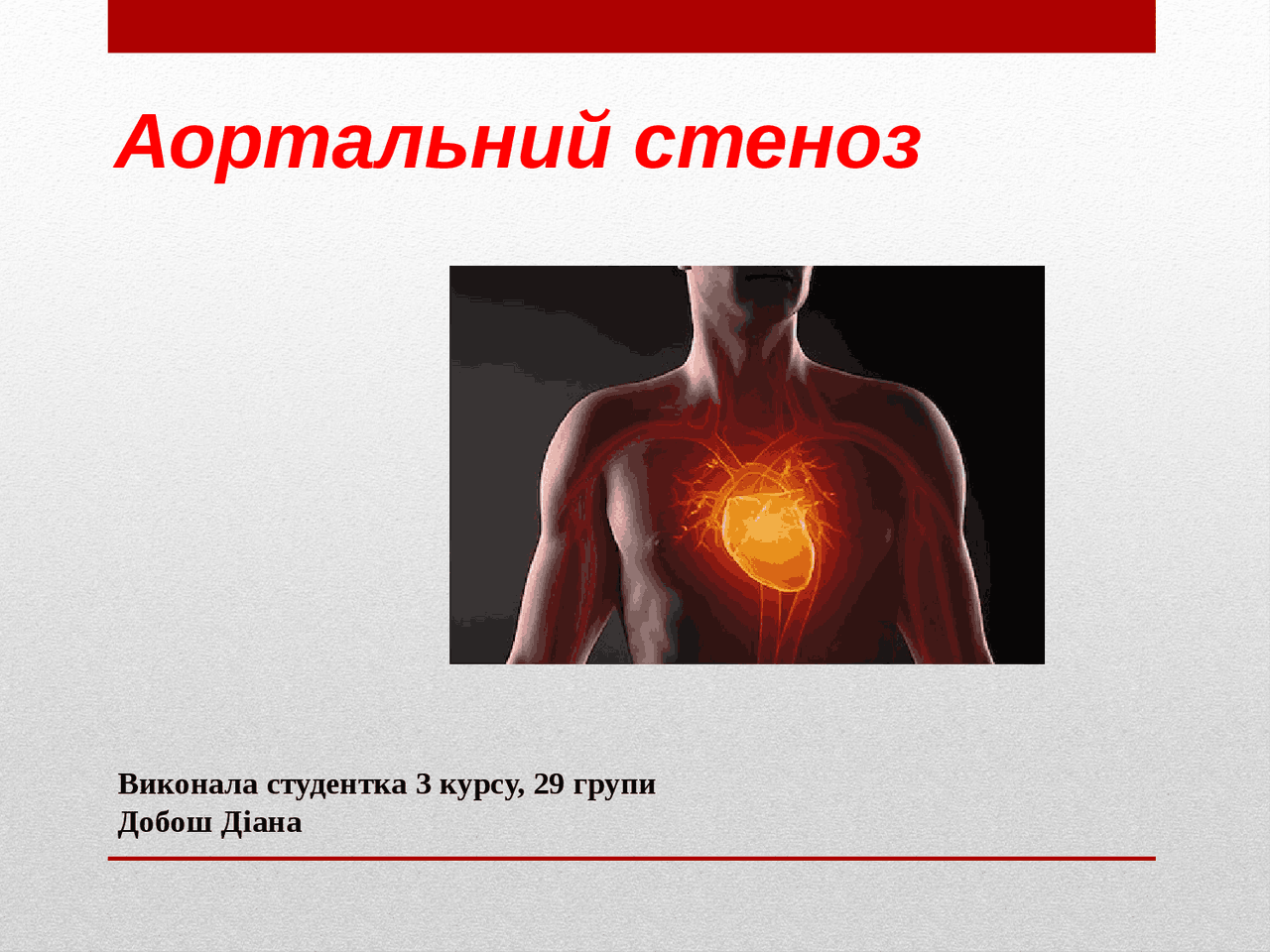 Лекція на тему Аортальний стеноз Docsity