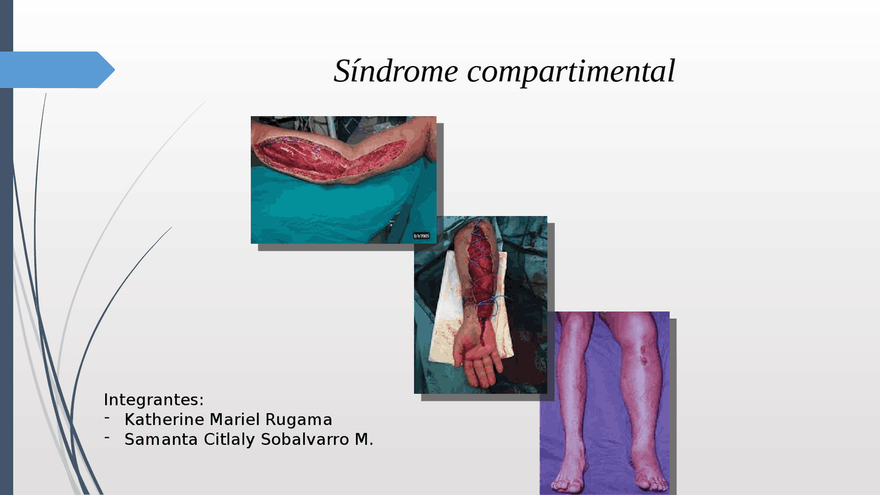 Síndrome compartimental | Esquemas y mapas conceptuales de Medicina ...