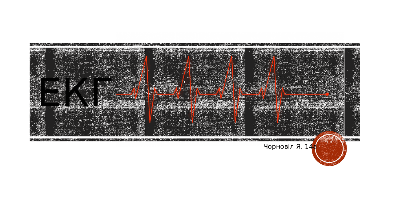 ЕКГ у фізичній реабілітації - Docsity