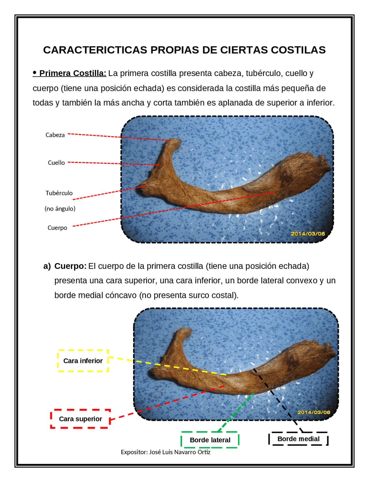 Características de Ciertas Costillas: Análisis de la Primera y Segunda ...