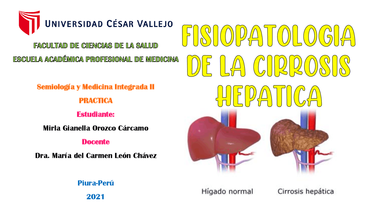 CIRROSIS HEPATICA y fisiopatología | Apuntes de Semiología | Docsity