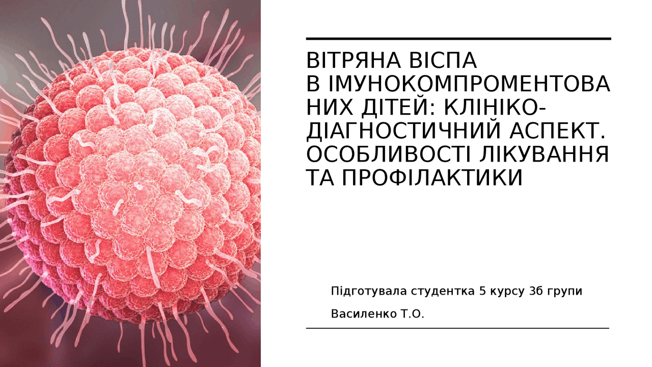 Вітряна віспа в імуноскомпрементованих дітей Docsity