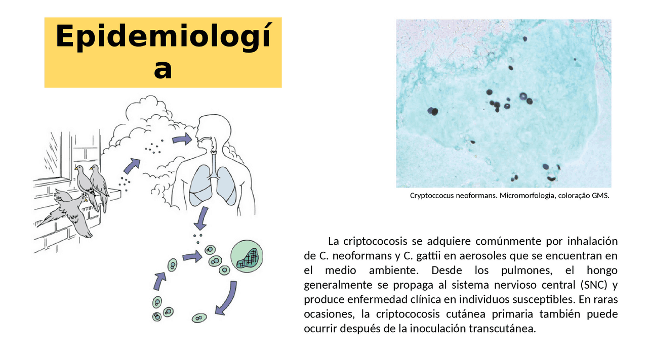 Microbiologia - criptococose | Esquemas Microbiologia - Docsity