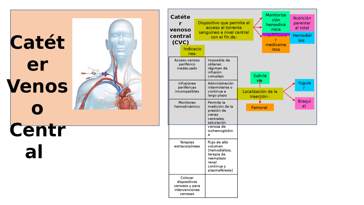 Cateter venoso central - Docsity