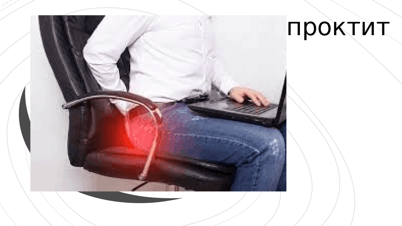 тема з хірургії Парапроктит Docsity