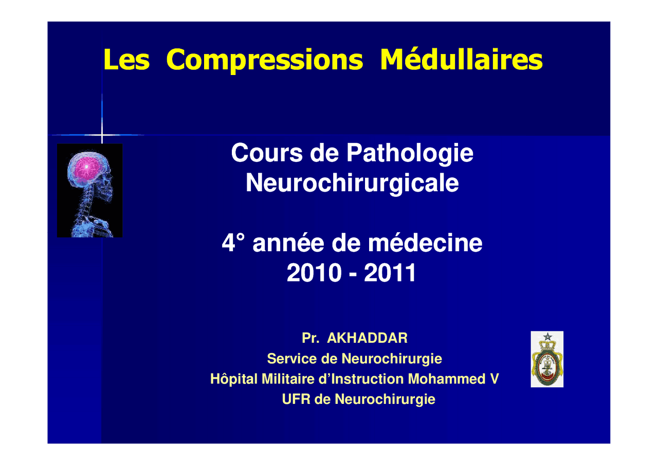 Les Compressions Médullaires Lentes - Docsity