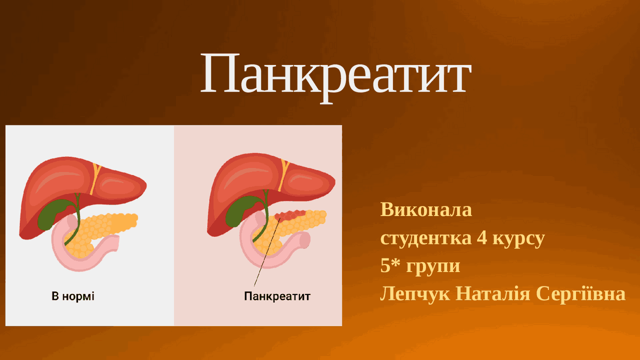 Гострий панкреатит історія хвороби Docsity