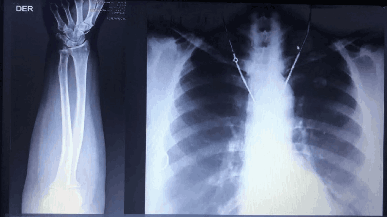 Diagnostico Por Imagenes Docsity