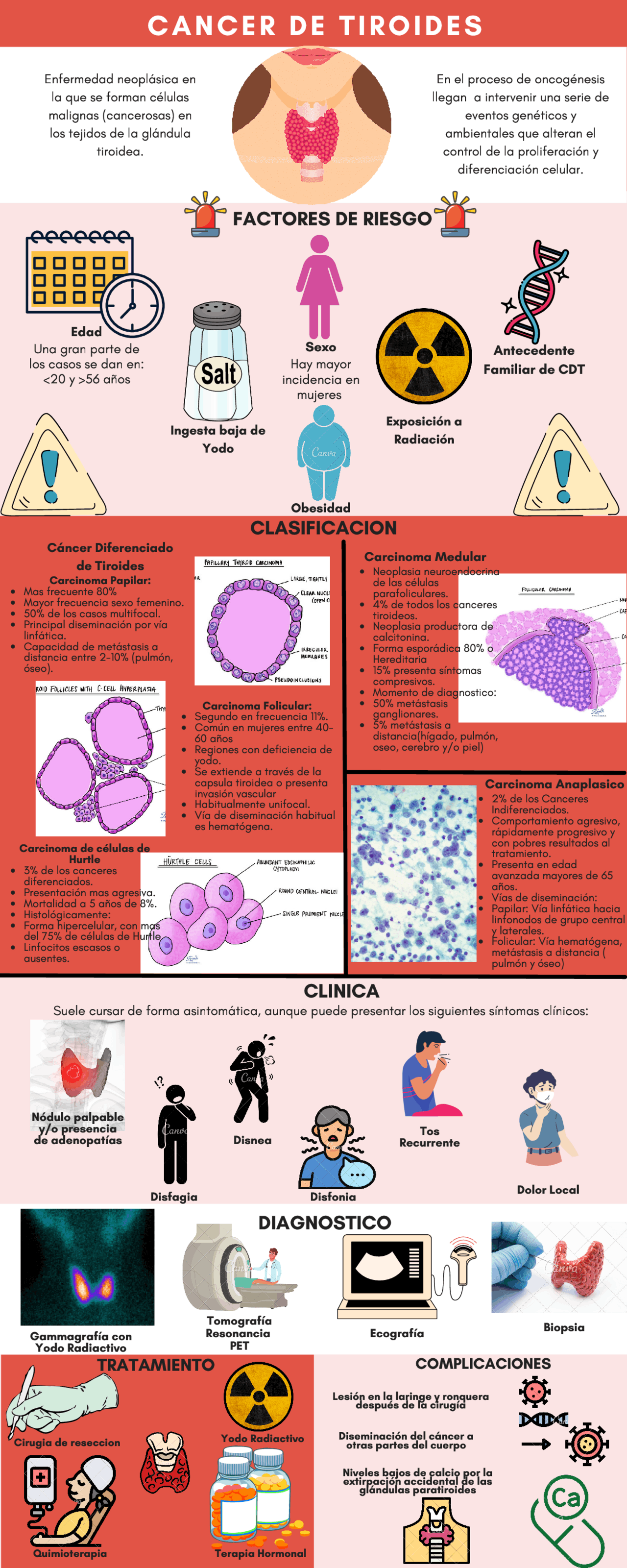 Infografia Cancer de Tiroides - Docsity