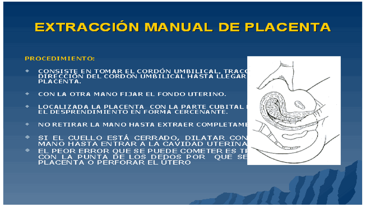 Alumbramiento manual | Esquemas y mapas conceptuales de Ginecología ...