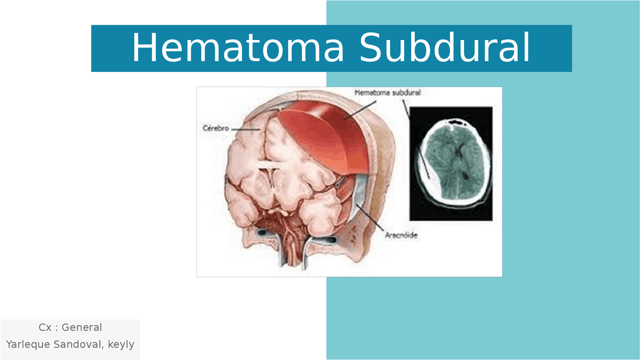 Fisiopatología de hematoma subdural | Esquemas y mapas conceptuales de ...