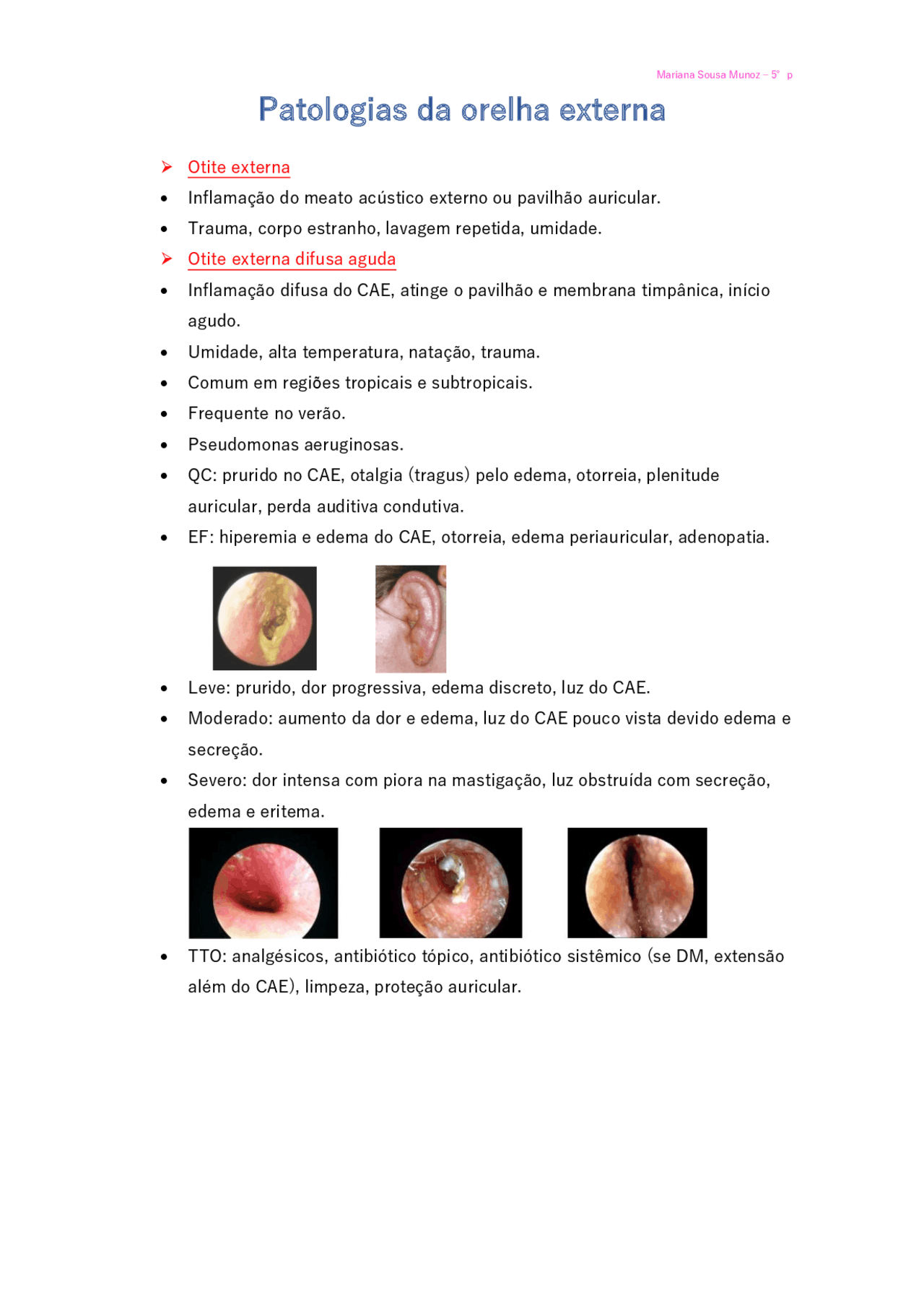 Otorrinolaringologia | Notas de estudo Otorrinolaringologia - Docsity