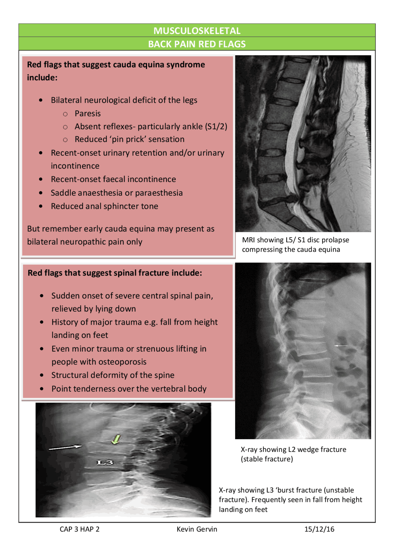 MUSCULOSKELETAL BACK PAIN RED FLAGS | Lecture notes History | Docsity