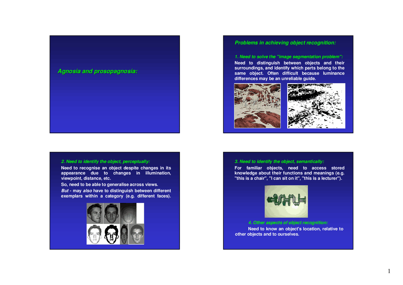 Understanding Agnosia and Prosopagnosia: Object and Face Recognition ...