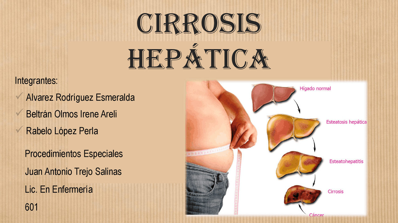 Exposición Cirrosis Hepatica | Diapositivas de Enfermería Clínica | Docsity