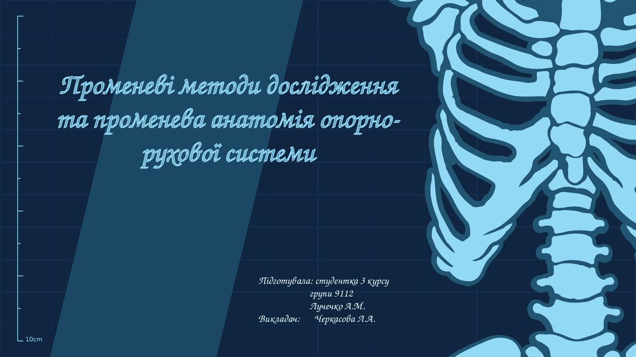 Презентація Променеве дослідження опорно рухової системи