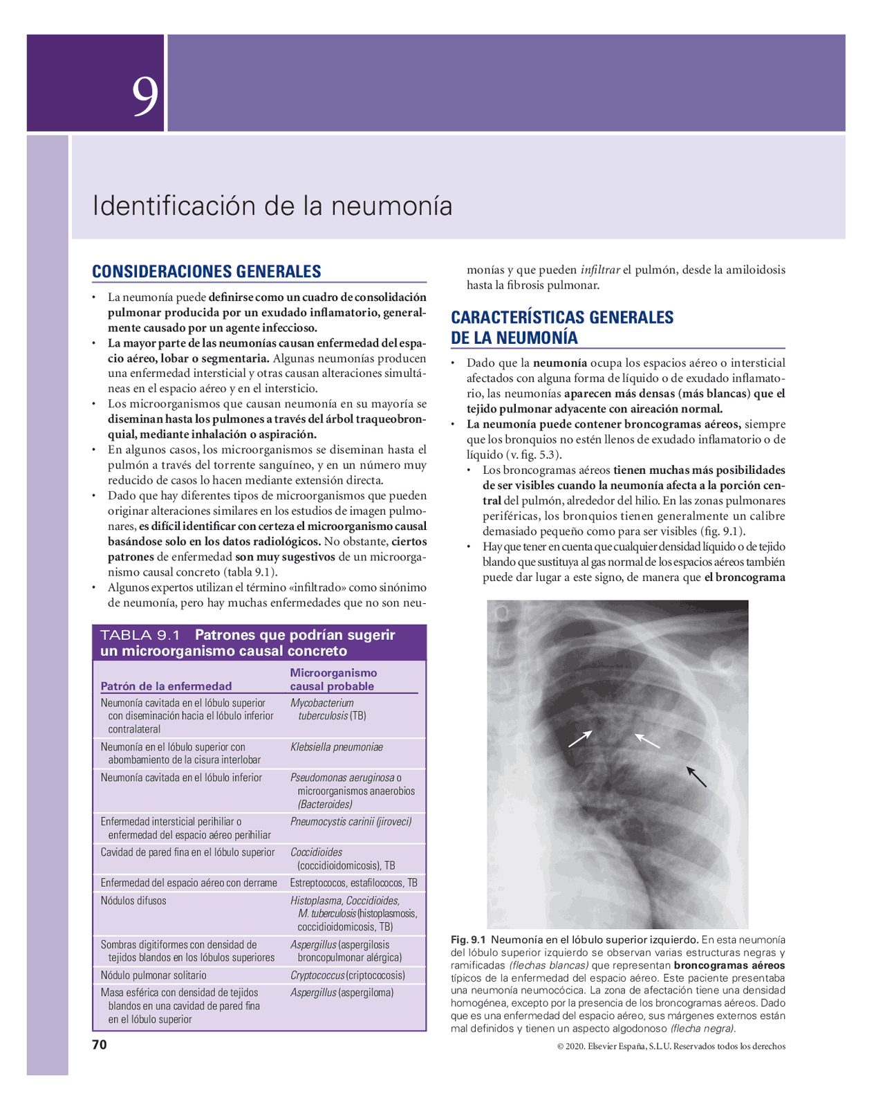 Capítulo 09 Identificación De La Neumonía.pdf | Guías, Proyectos, Investigaciones de Morfología ...
