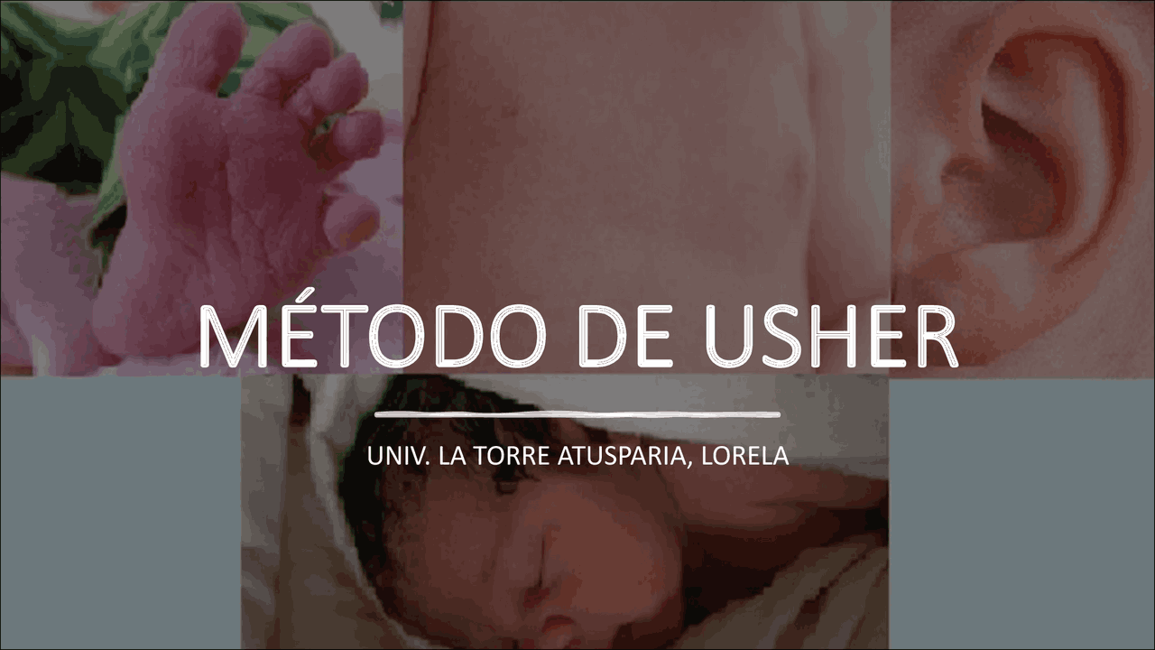Metodo De Usher En Recien Nacidos Diapositivas De Pediatría Docsity