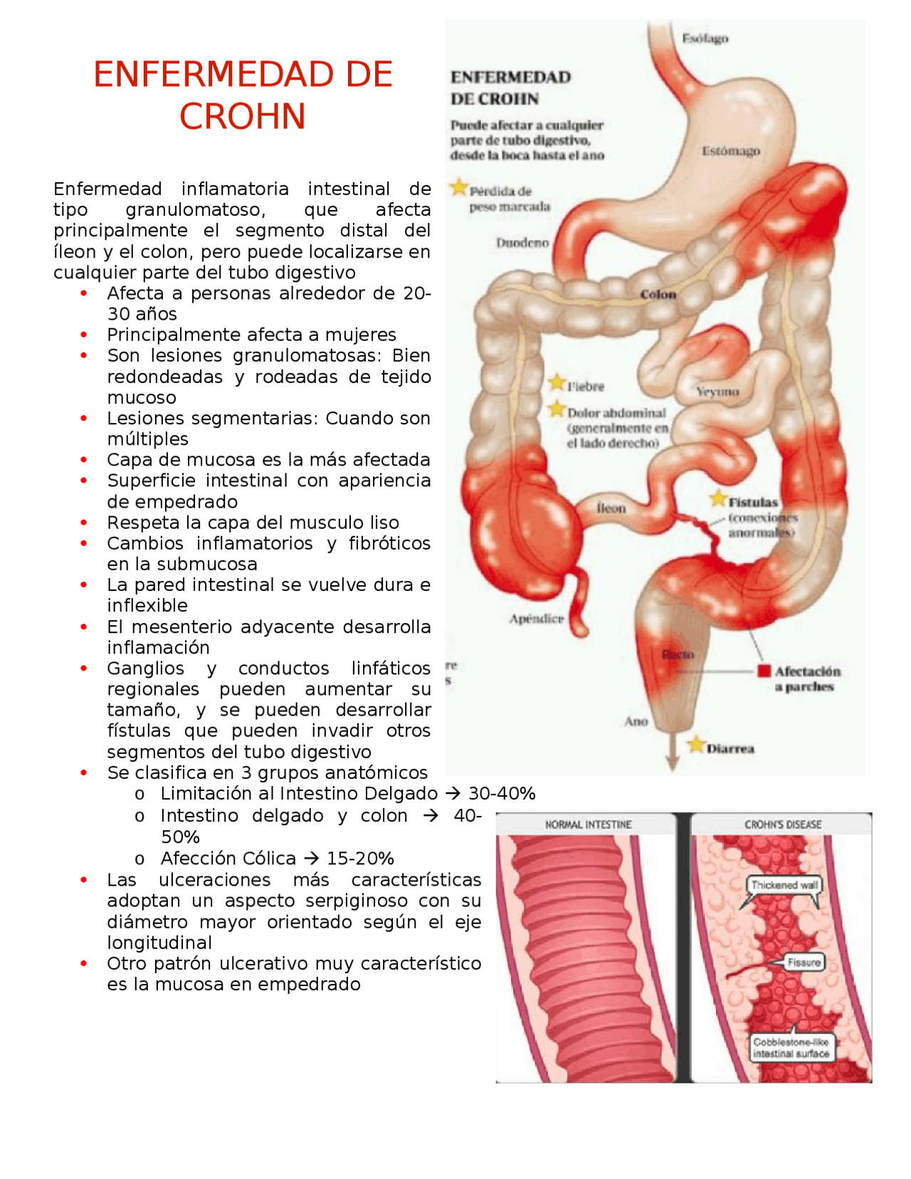 Enfermedad de Crohn | Resúmenes de Gastroenterología | Docsity