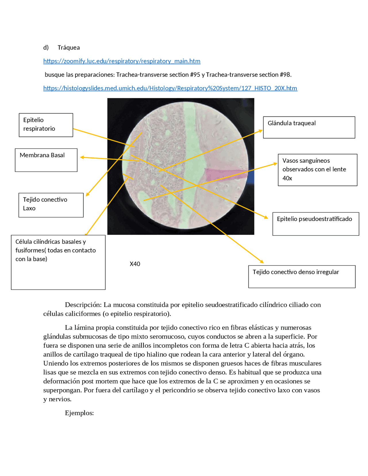 Anatomia De Traquea Histología Resúmenes De Anatomía Docsity