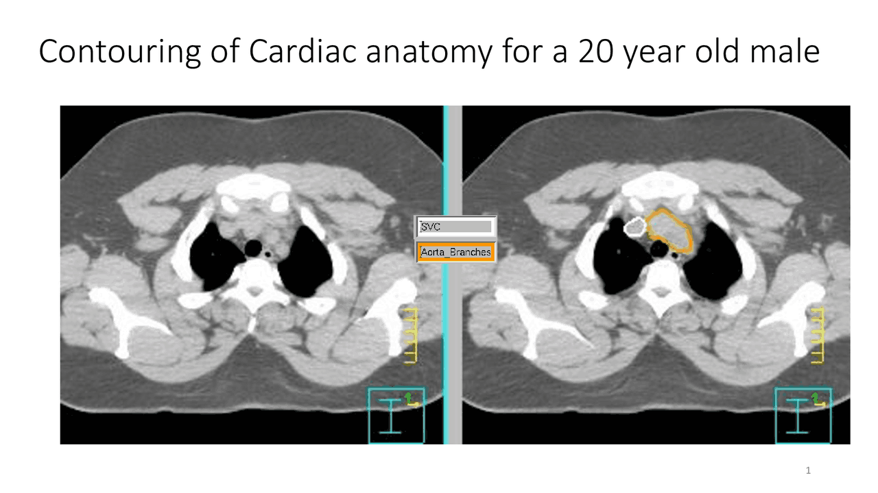 Heart And Sub Structures Exams Anatomy Docsity