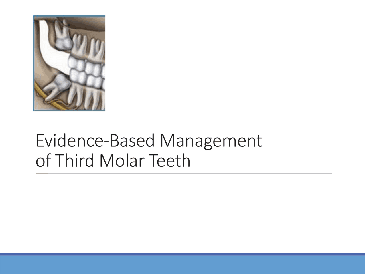 Evidence Based Management of Third Molar Teeth | Lecture notes ...