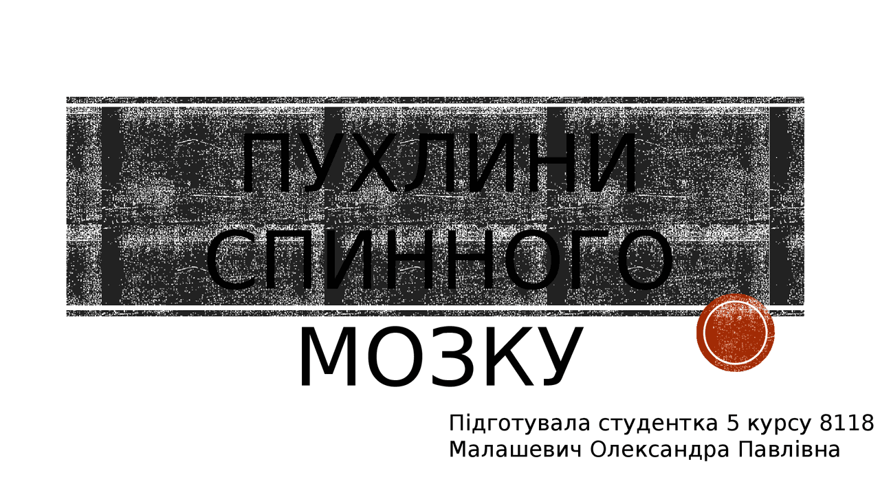 Пухлини спинного мозку Схемы Хирургия Docsity