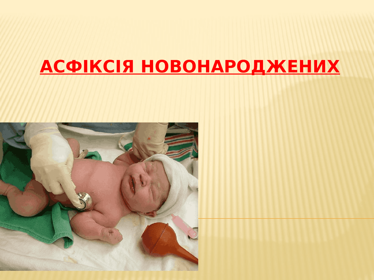 Асфіксія новонароджених Презентации Педиатрия Docsity