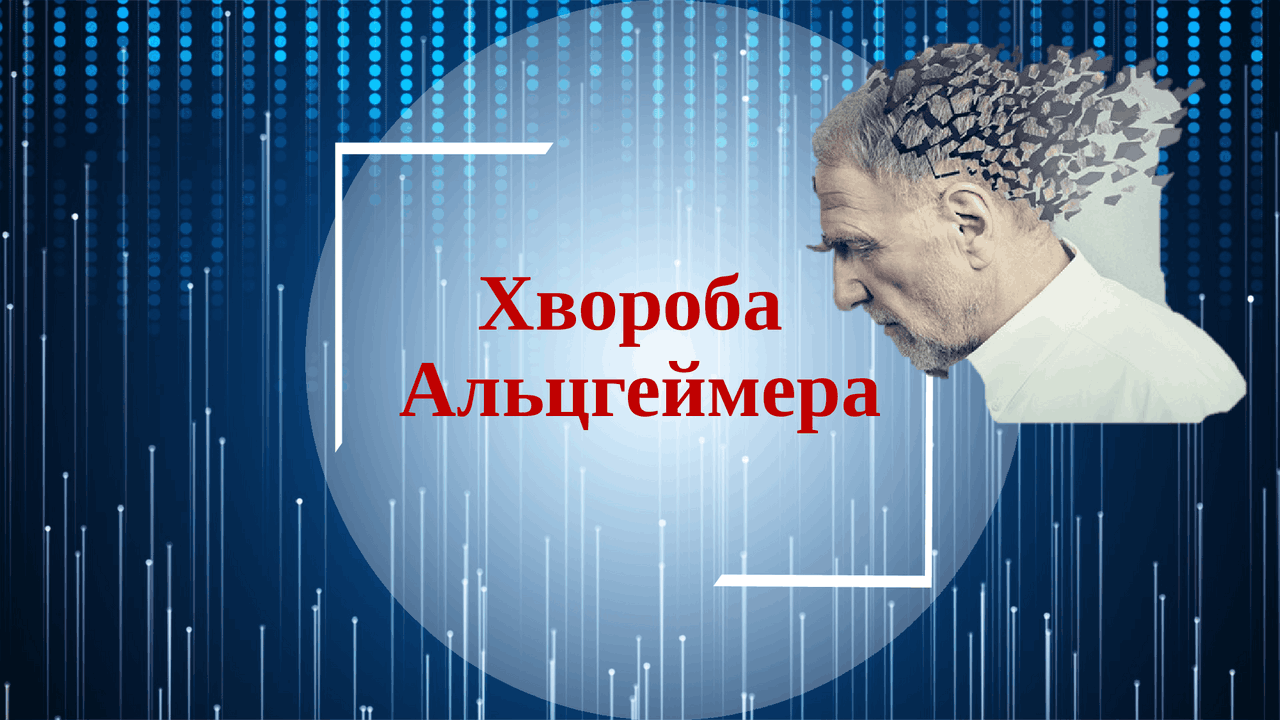 презентація на тему Хвороба Альцгеймера Презентации Неврология