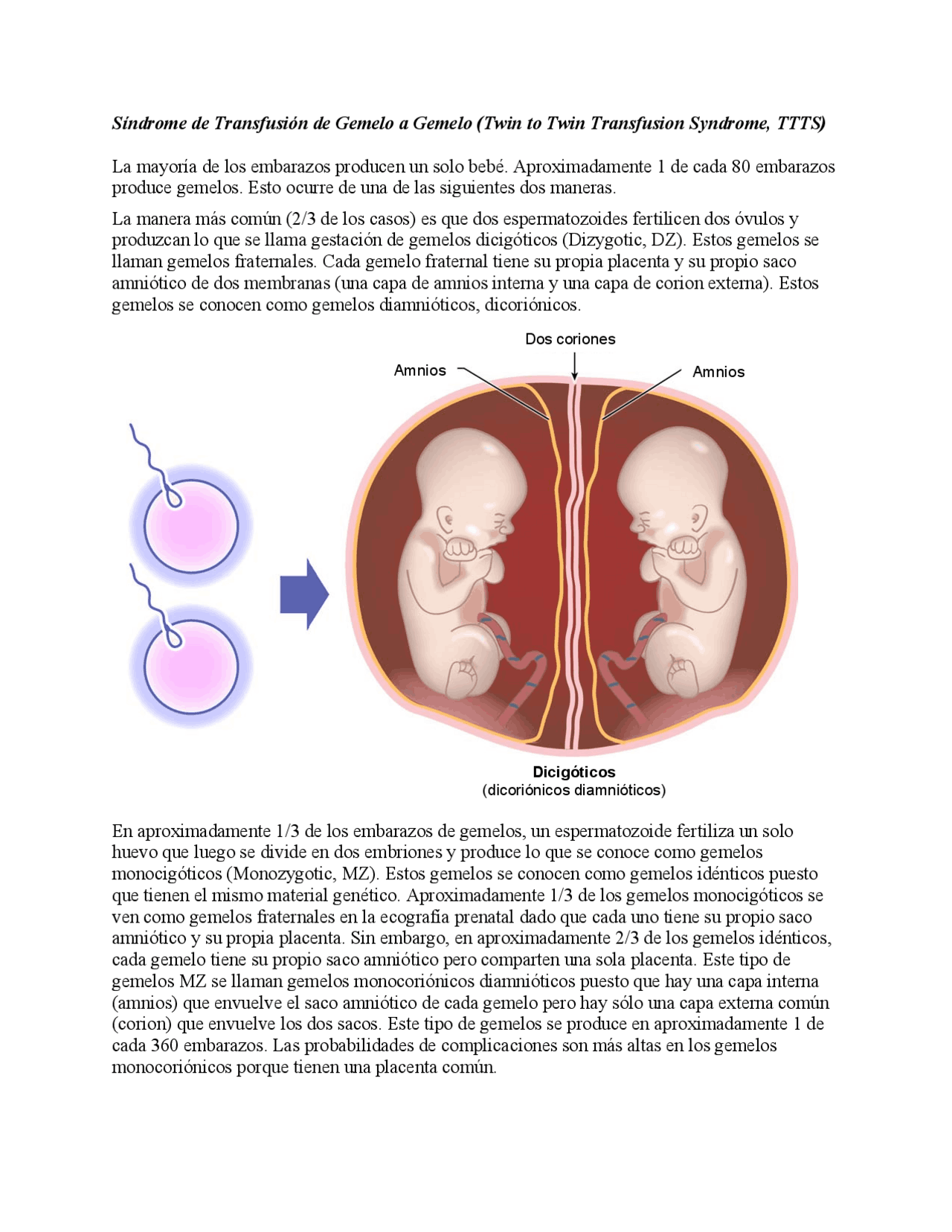 ¿Cómo se diagnostica el Síndrome de Transfusión de gemelo ...