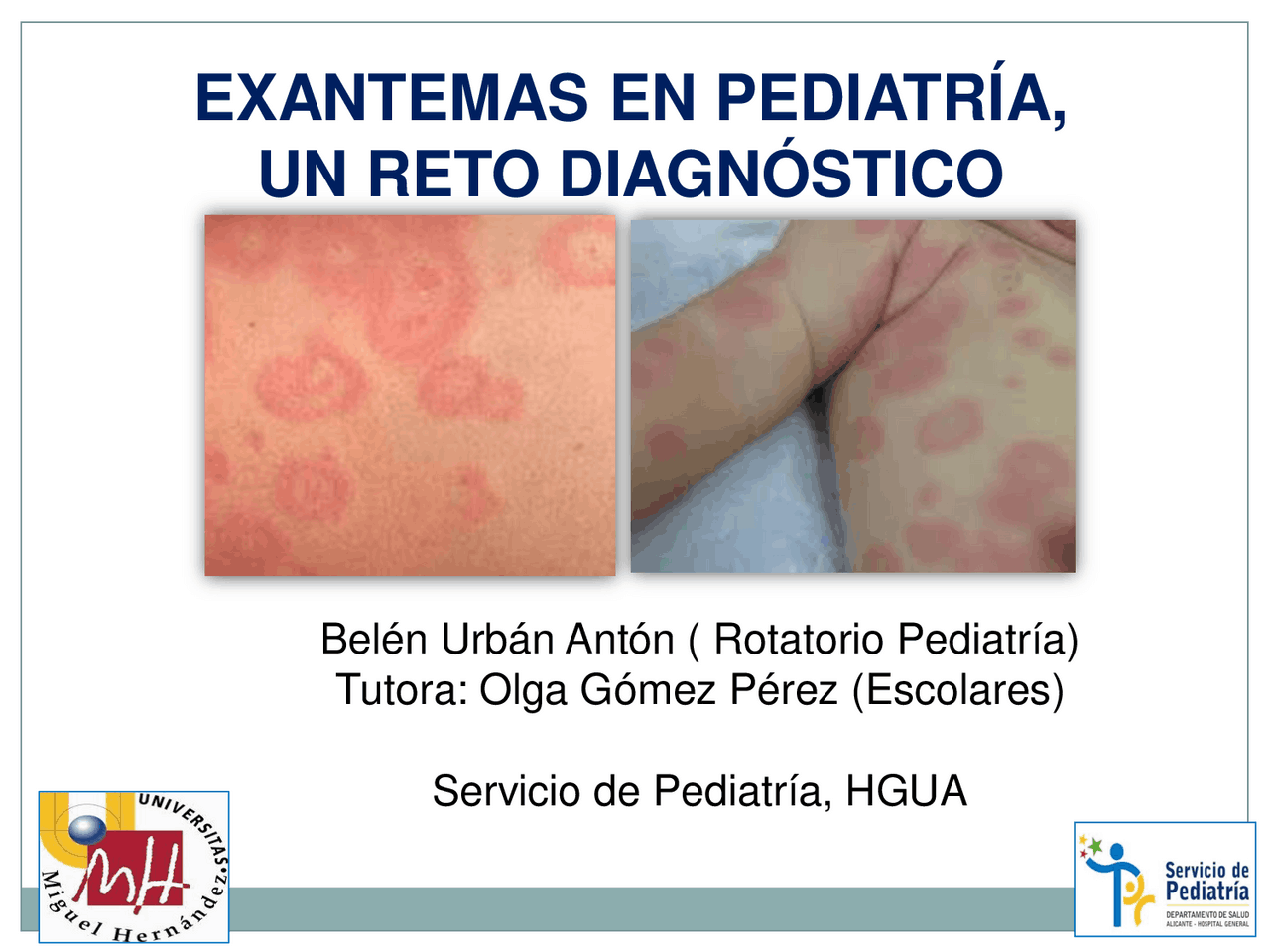 Exantemas en pediatría, un reto diagnóstico | Apuntes de Pediatría ...