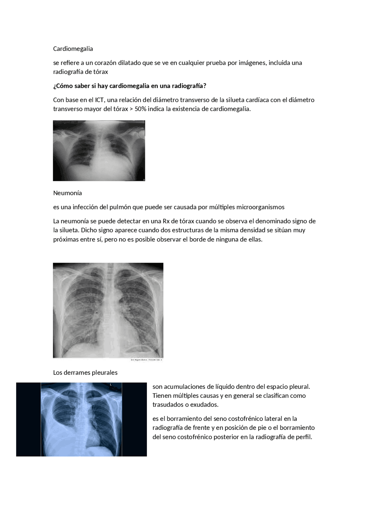 Patologias del torax | Resúmenes de Imagenología | Docsity