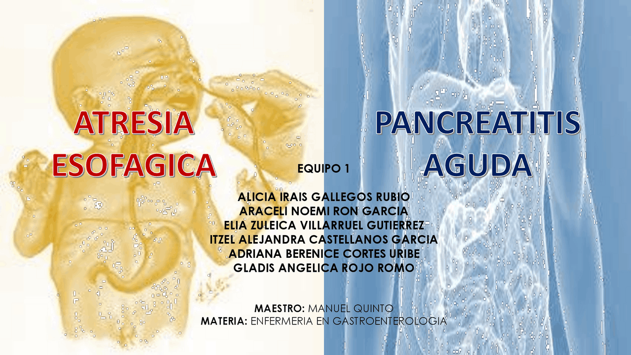 ATRESIA ESOFAGICA EN EL PACIENTE PEDIATRICO | Diapositivas de ...
