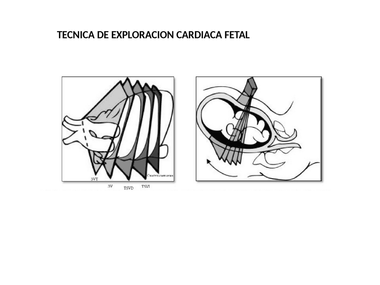 Cortes de yagel en ecocardiografia | Diapositivas de Embriología | Docsity