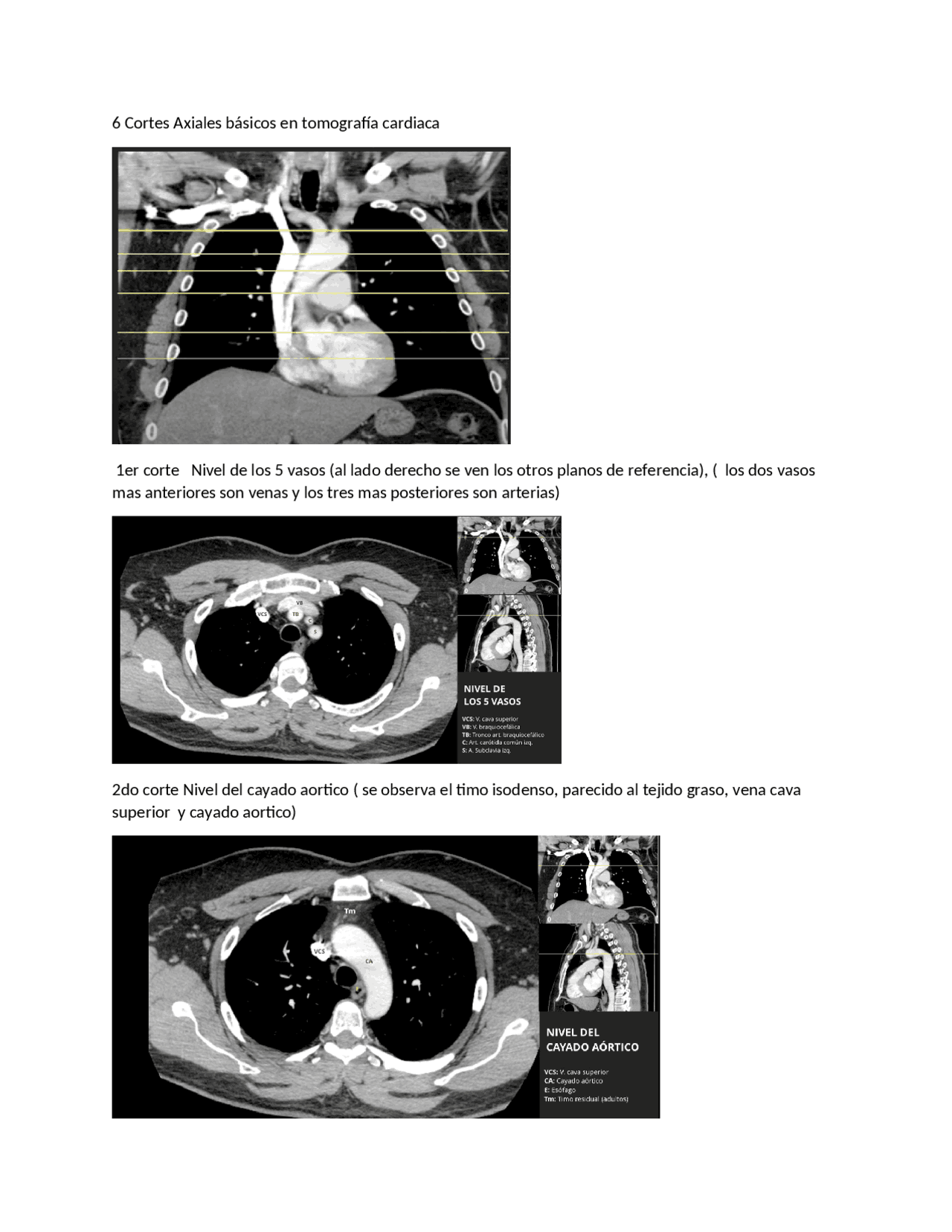 Anatomia Multiplanar Resúmenes De Radiología Docsity