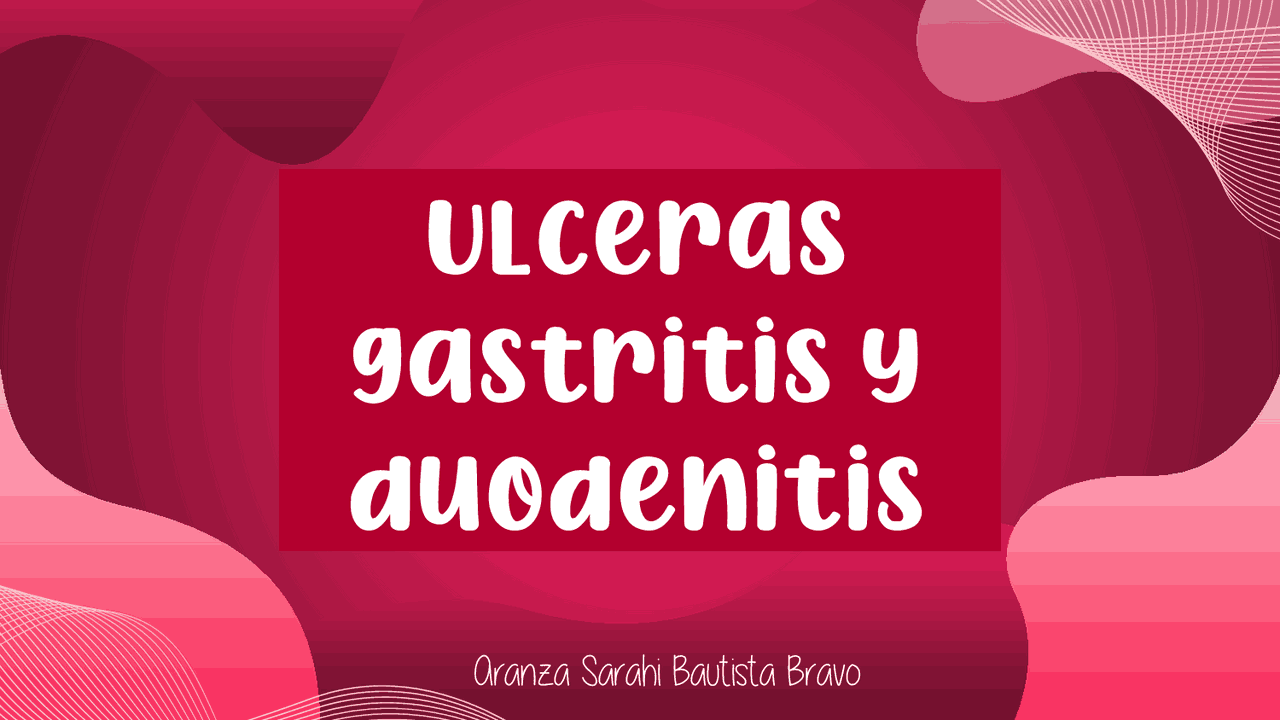 Gastritis, duodenitis y ulceras | Diapositivas de Gastroenterología | Docsity