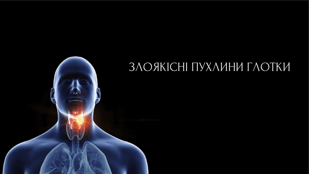 Злоякісні пухлини глотки Презентации Оториноларингология Docsity