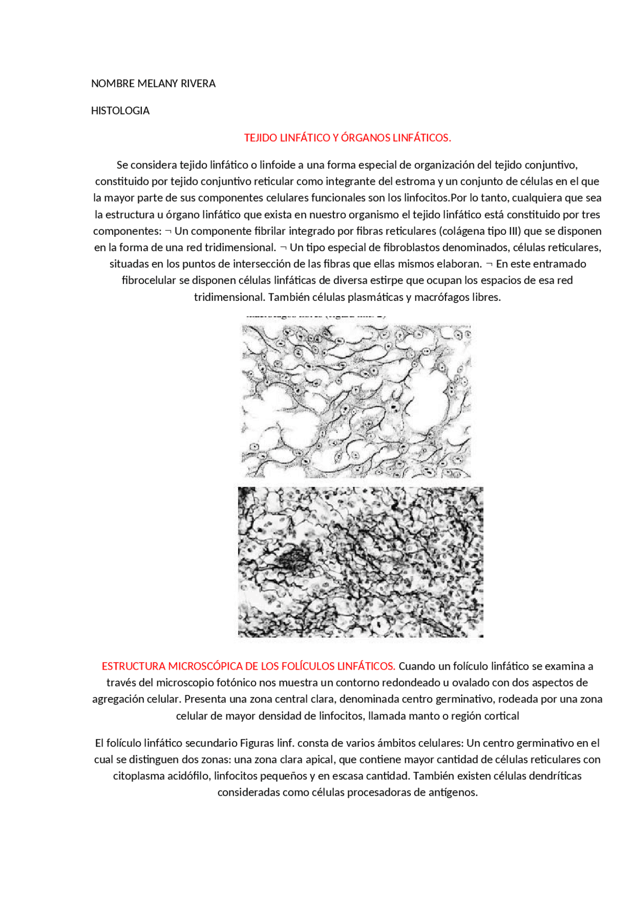 Tejido LinfÁtico Y Órganos LinfÁticos Apuntes De Histología Docsity