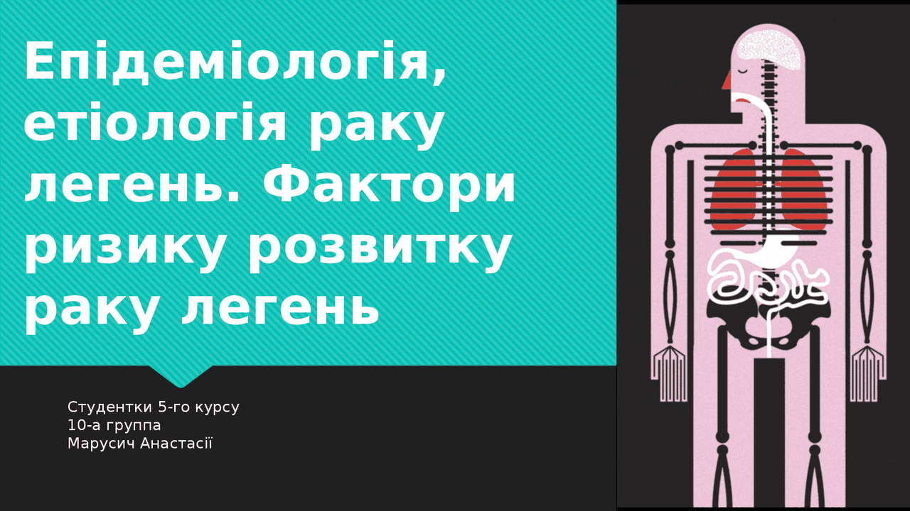 Рак легень Презентація Презентации Онкология Docsity
