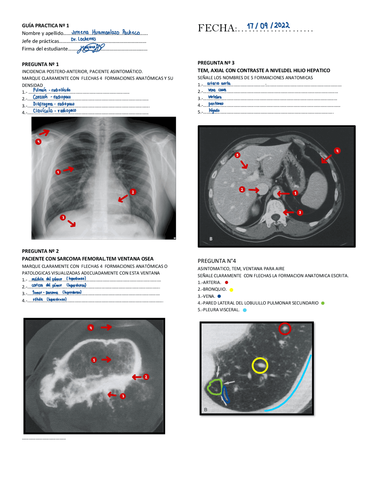 Diagnóstico Por Imagenes 1 Exercices De Radiographie Docsity