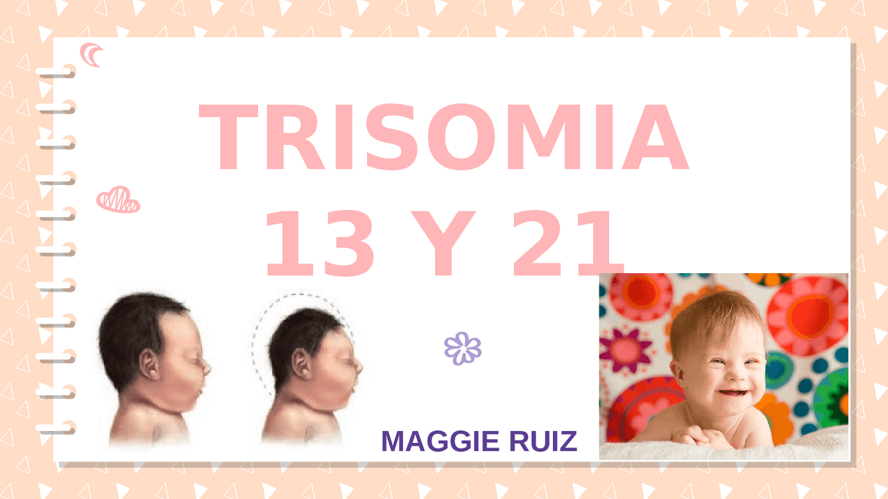 TRISOMIA 21 Y 13 (SINDROME DOWN Y PATAU) | Esquemas y mapas ...