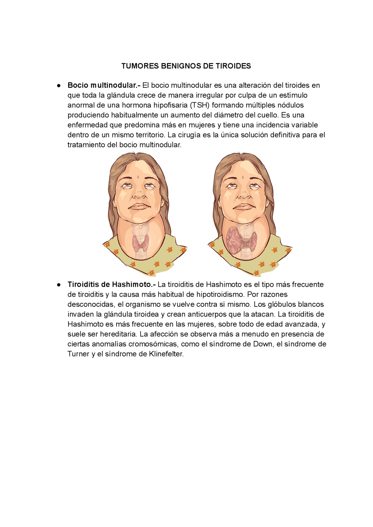 Tumores Benignos De Tiroides Resúmenes De Cirugía General Docsity