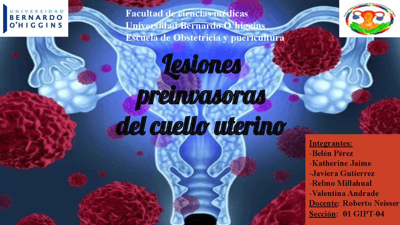 Lesiones preinvasoras de cuello uterino: Definición, causas, manifestaciones y diagnóstico ...