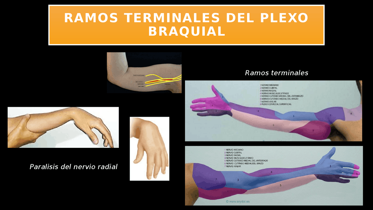 Ramos terminales del Plexo braquial Y Paralisis del Nervio Radial ...