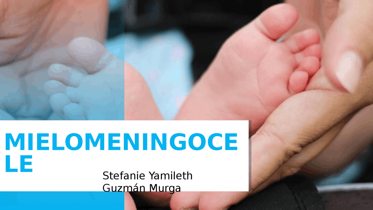 Mielomeningocele: Definición, Causas, Sintomatología y Tratamiento | Diapositivas de Cirugía ...