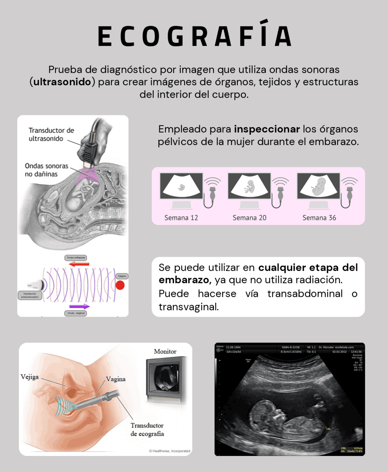 Ecografía fetal (ultrasonido fetal) | Apuntes de Obstetricia | Docsity