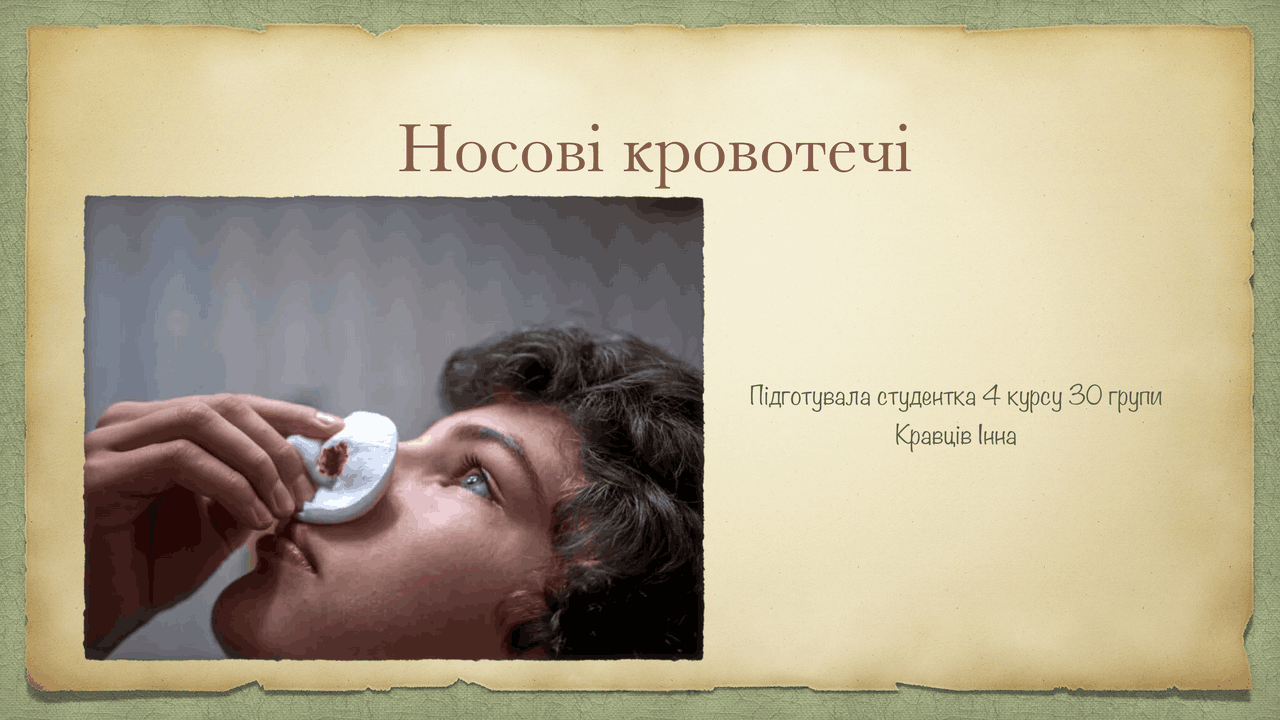 носові кровотечі презентація Презентации Оториноларингология Docsity